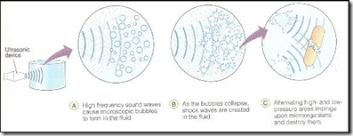 Microbiology Online: Ultrasonic Vibrations